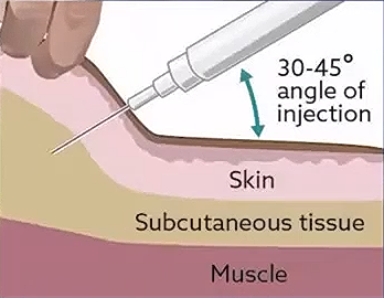 FIP Treatment – Treat FIP